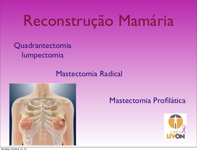 Aspectos atuais sobre cirurgia da mama