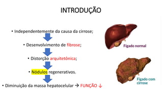 Aula Patologia - cirrose hepática.pptx