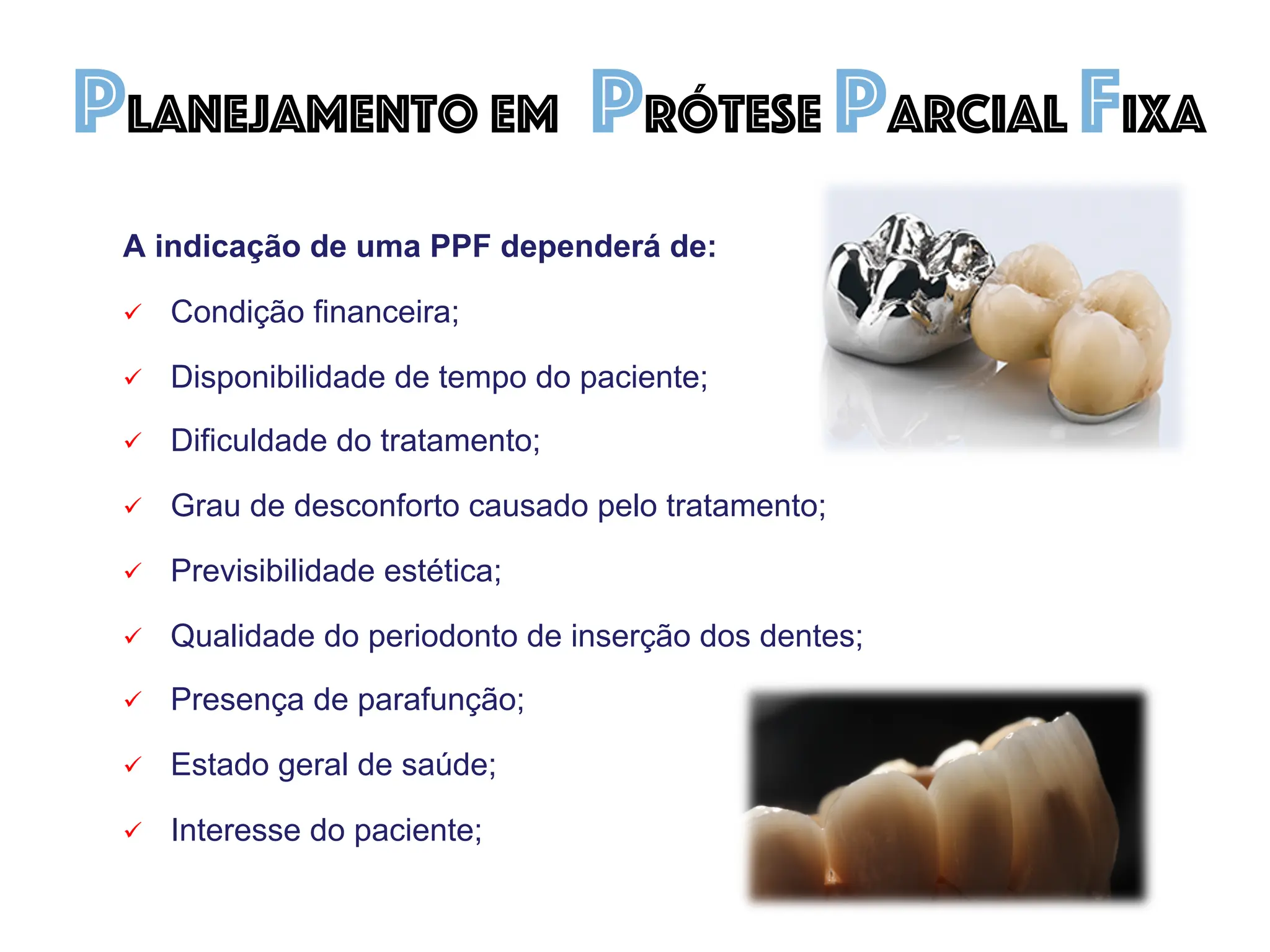 Aula prótese parcial fixa disciplina PPF | PDF