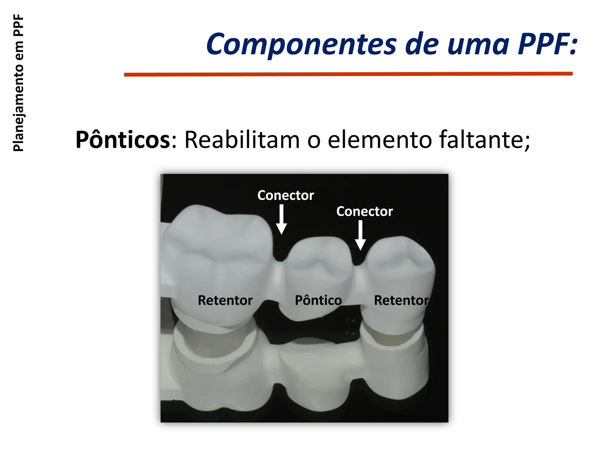 Aula prótese parcial fixa disciplina PPF | PDF