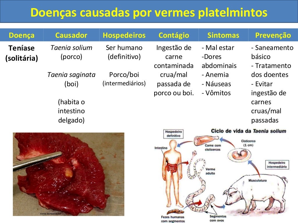 Doenças Causadas Por Helmintos - FDPLEARN