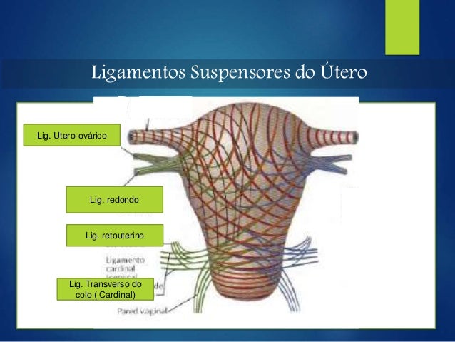 Histerectomia - LACAS - Rodrigo Mont'Alverne