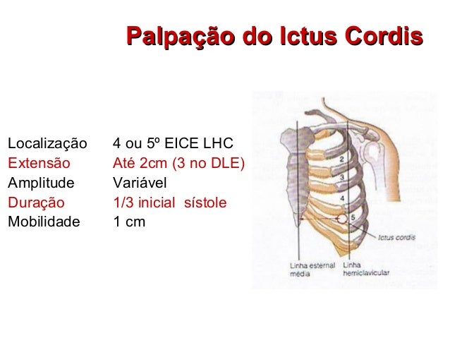 Ictus Cordis