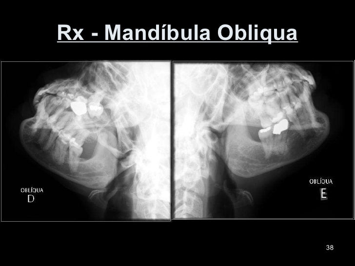 Aula Sobre Atm E Mandíbula Raios X