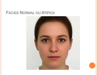 AULA SOBRE OS TIPOS DE FÁCEIS .ppt