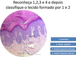 Aula tecido epitelial silene | PDF