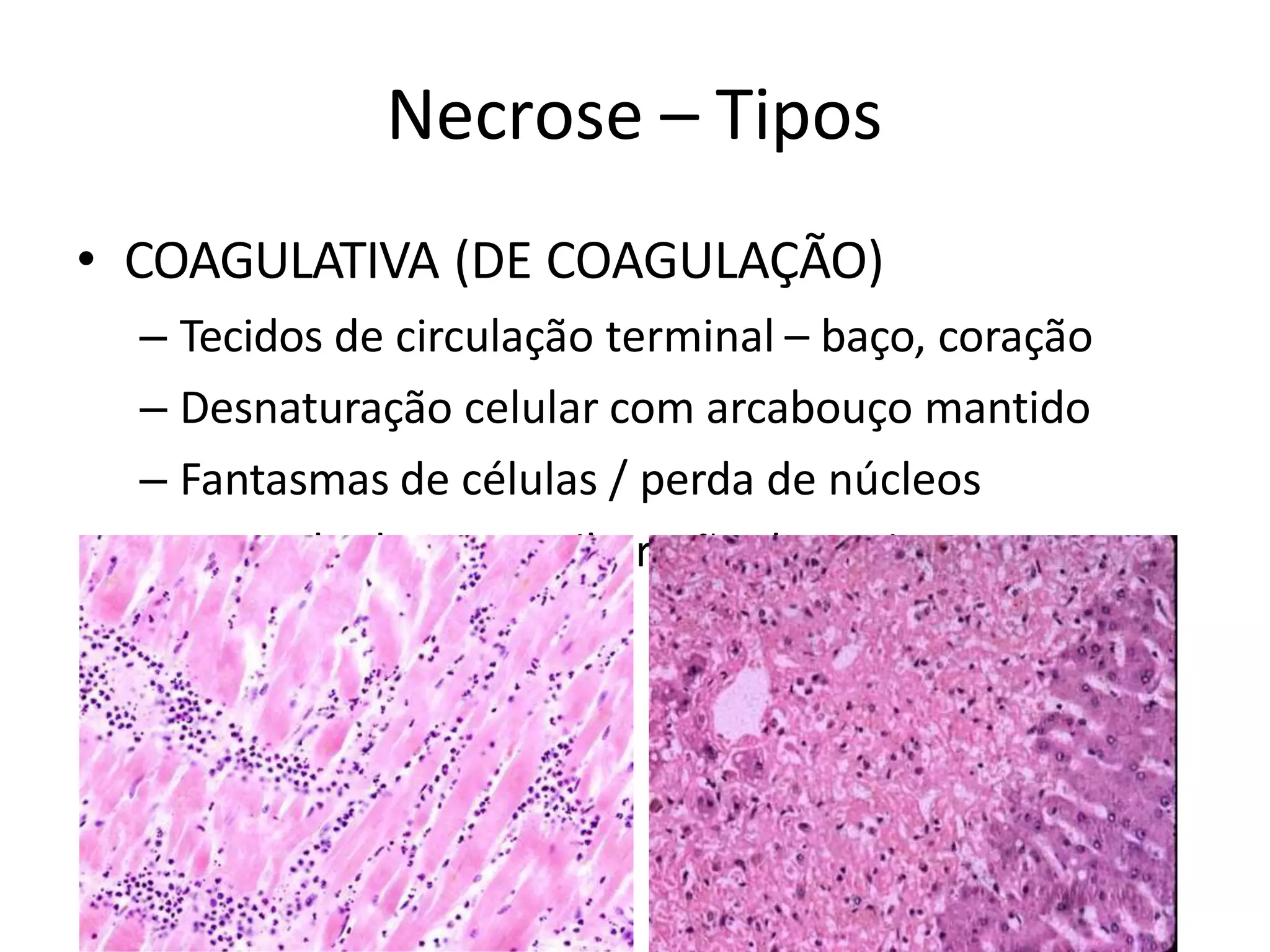 Aula Tipos de morte celular | PPTX