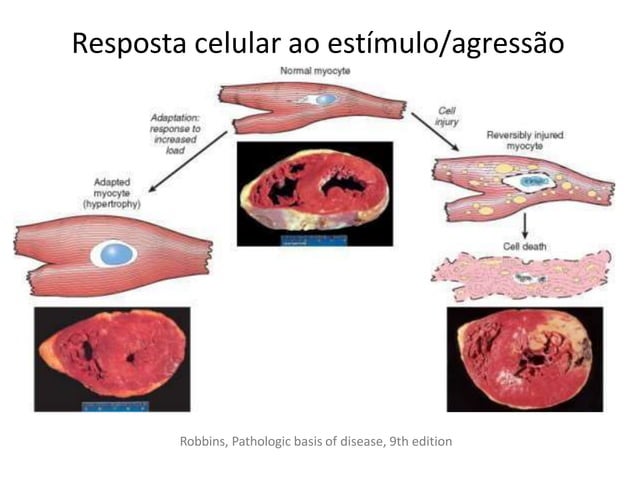 Aula Tipos de morte celular