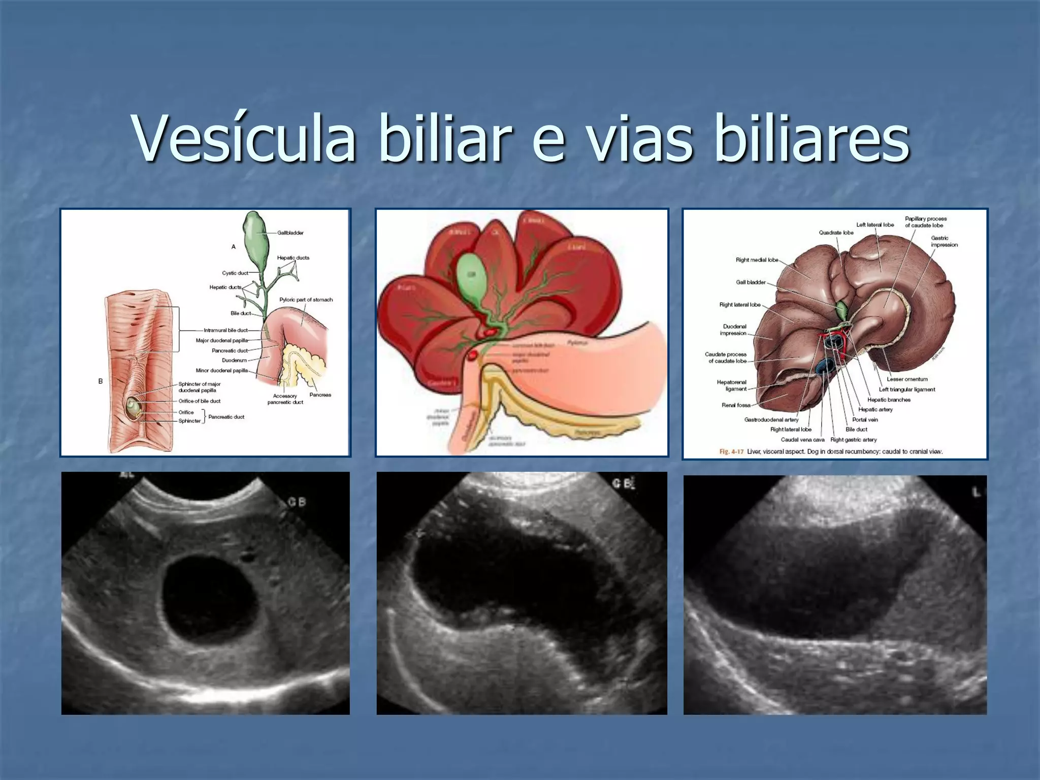 Ultrassonografia Anatomia Da Vesicula Biliar