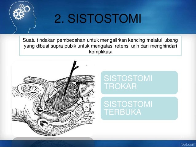 Aulia venny dt retensi urin dr. indra