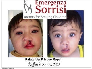 Aumento labbra Napoli: Dr. Rauso | PDF
