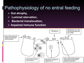 Aung myo zaw(nutrition in preterm and congenital hypotrophy) | PPT