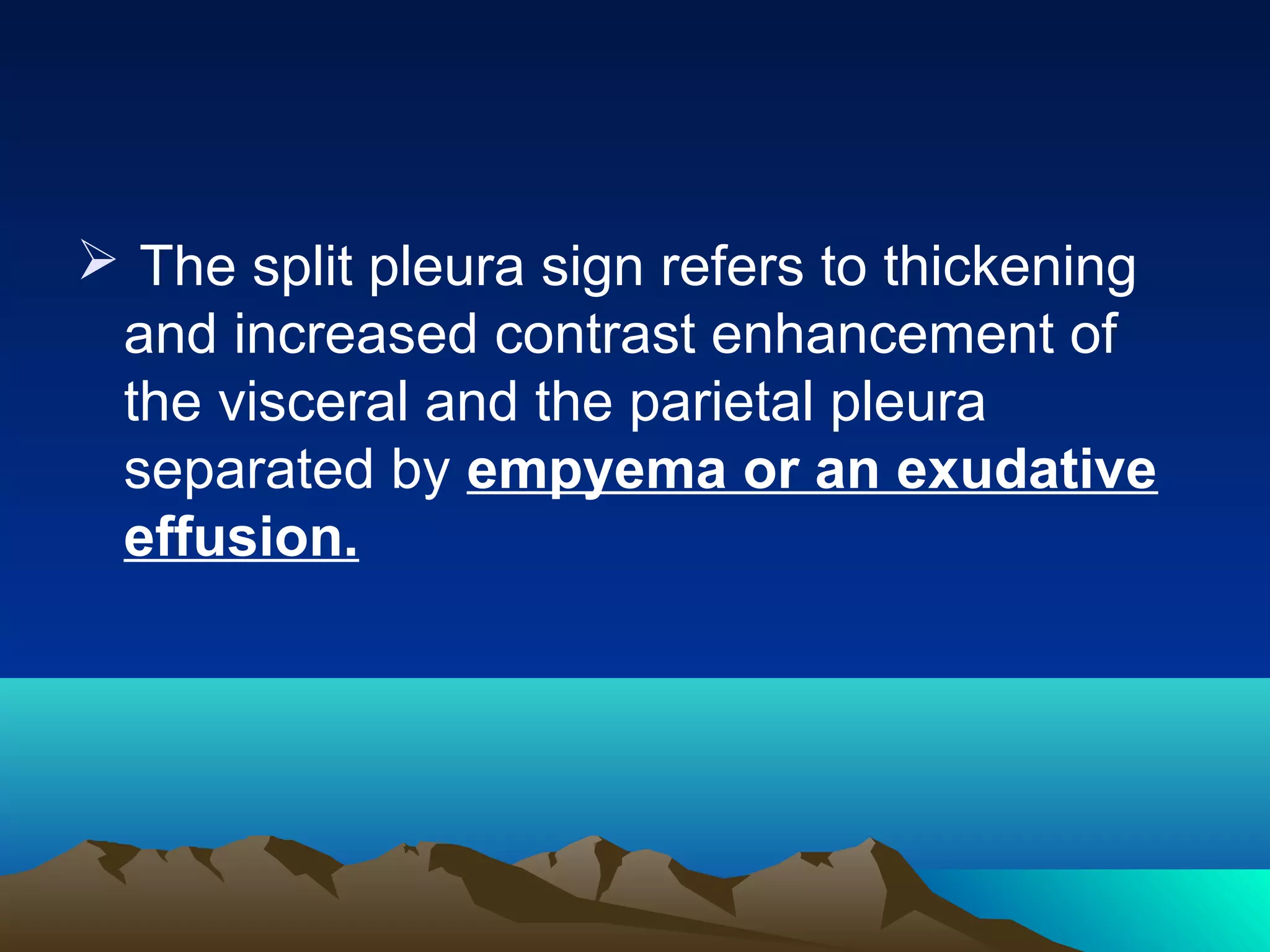 Radiology signs | PPT