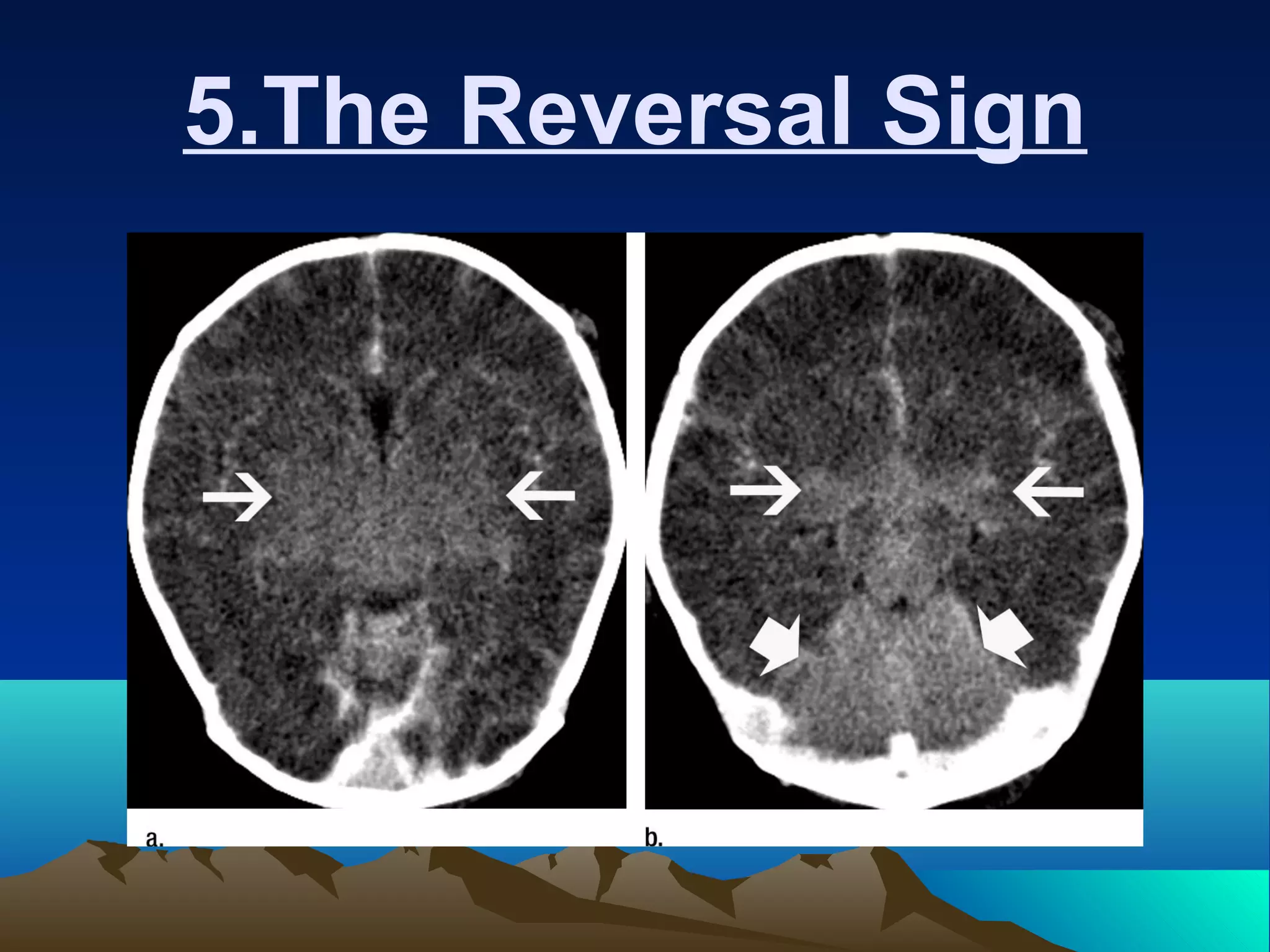 Radiology signs | PPT