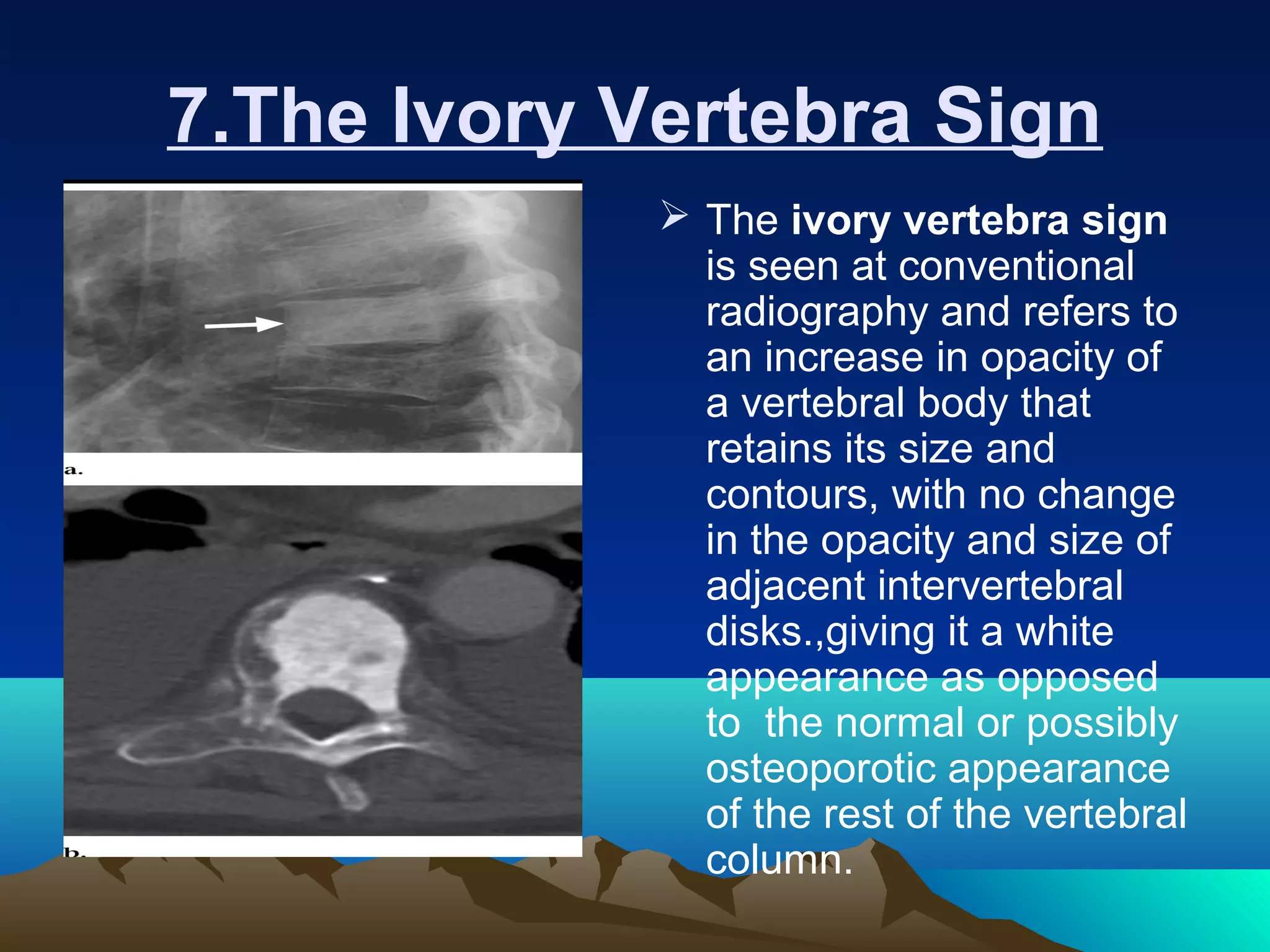 Radiology signs | PPT