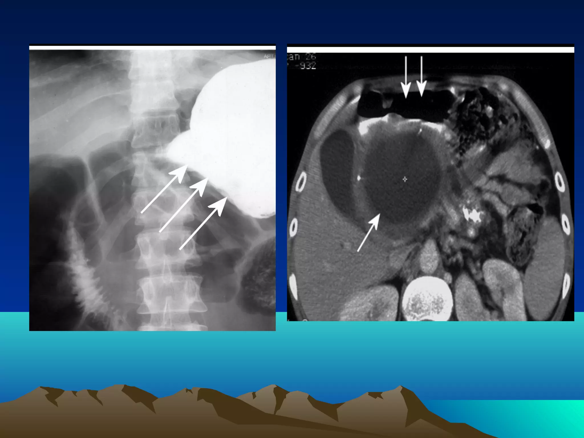 Radiology signs | PPT