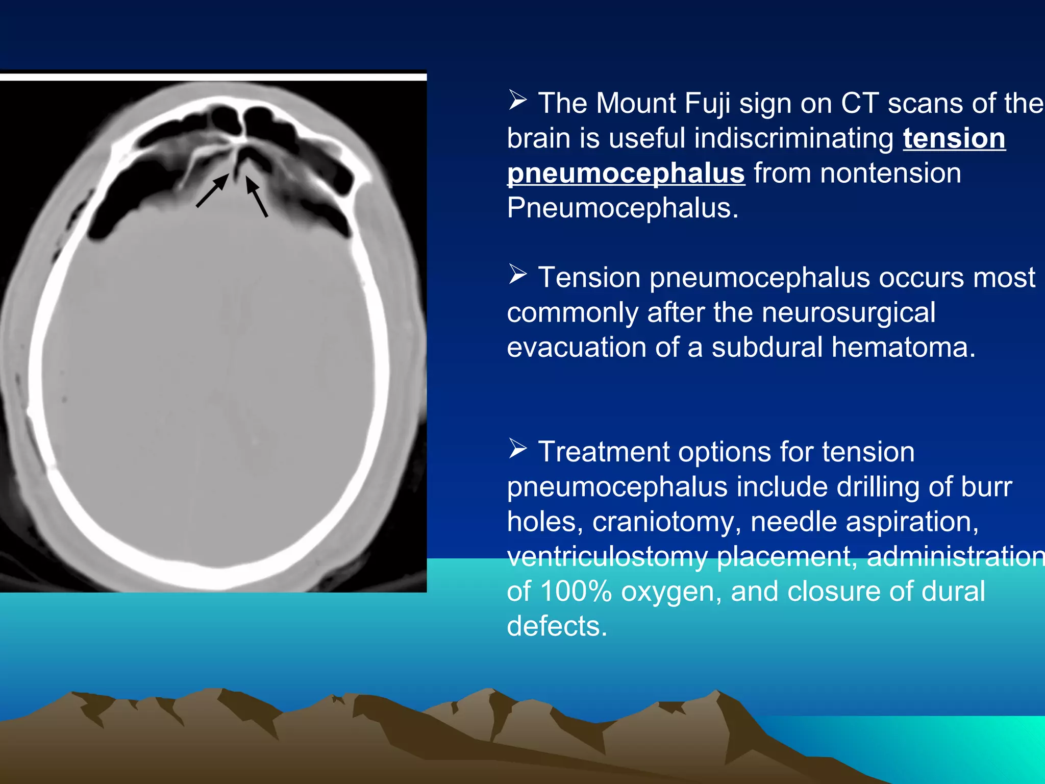 Radiology signs | PPT