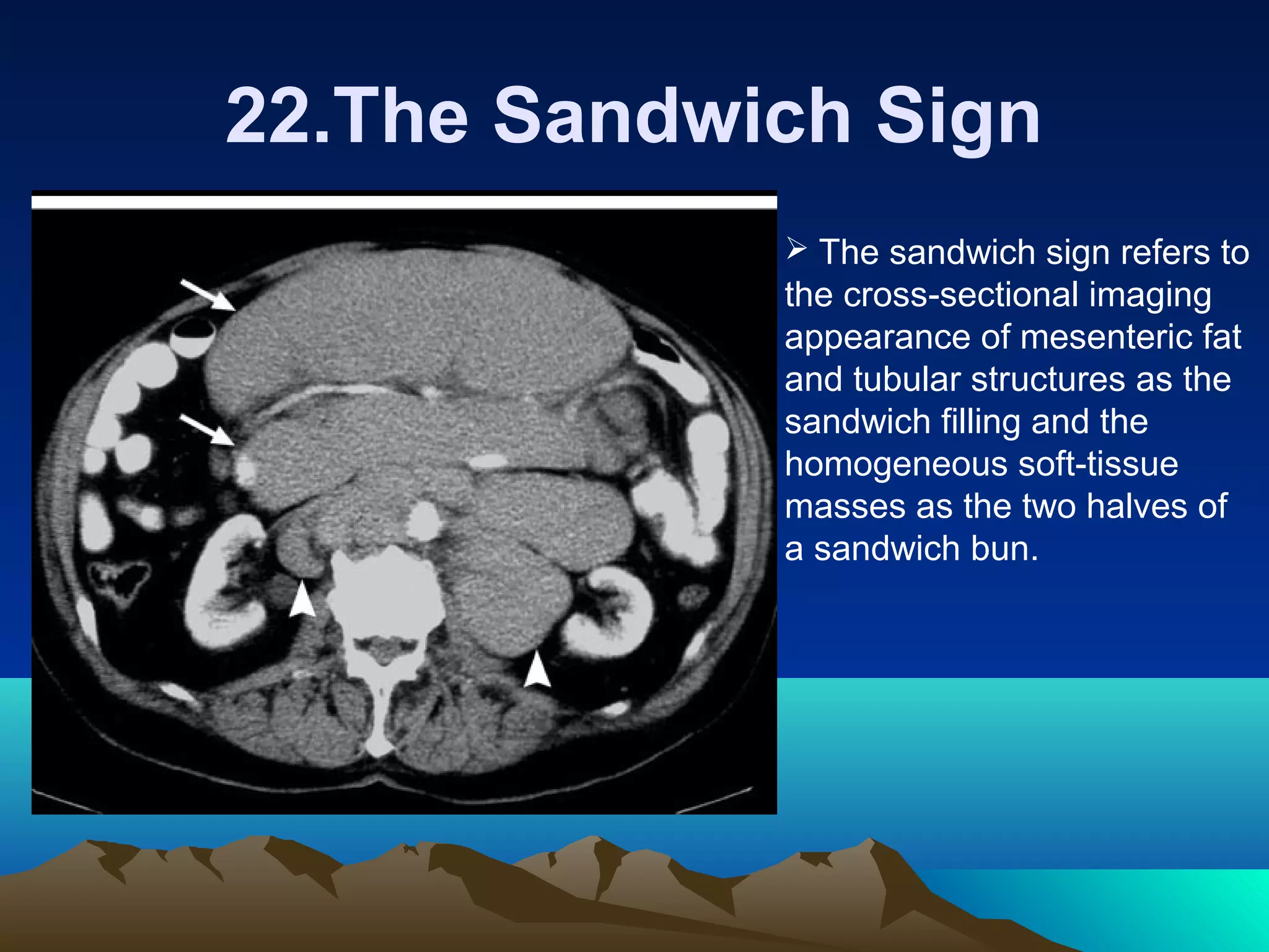 Radiology signs | PPT
