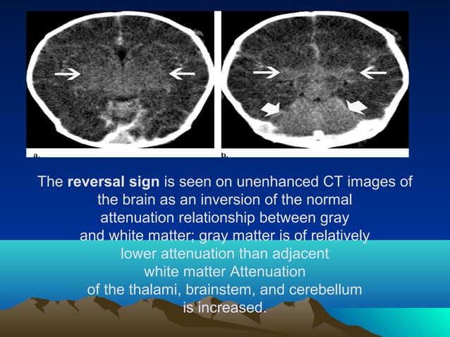 Radiology signs | PPT
