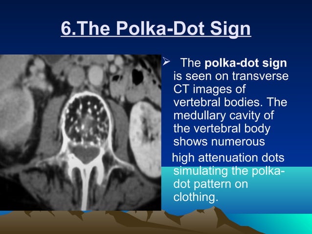 Radiology signs | PPT