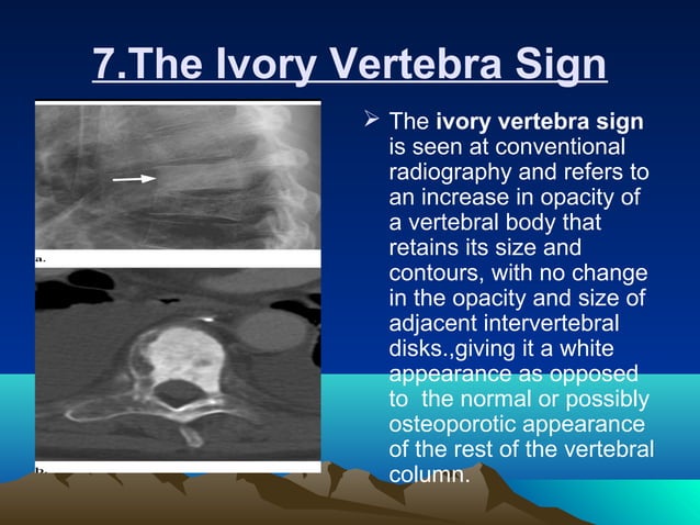 Radiology signs | PPT