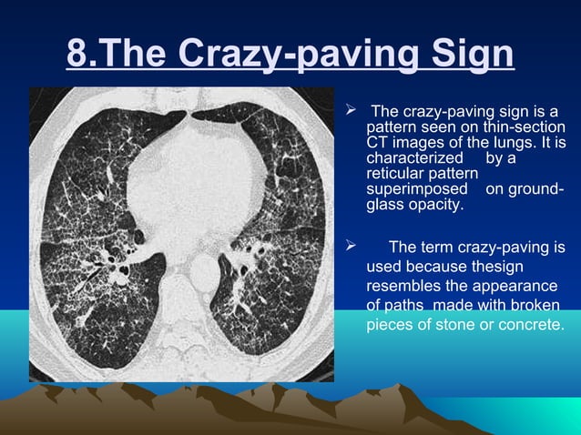 Radiology signs | PPT