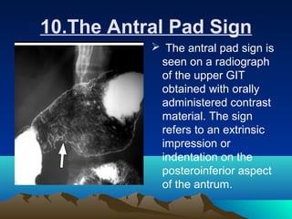 Radiology signs | PPT