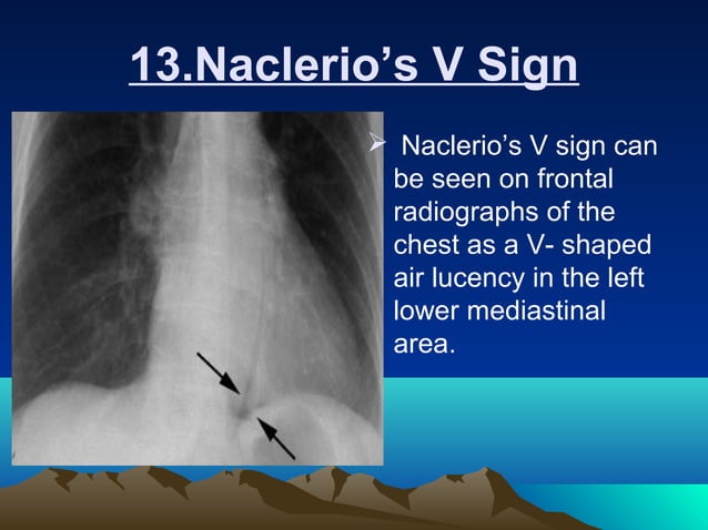 Radiology signs | PPT