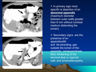 Radiology signs | PPT