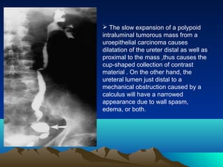 Radiology signs | PPT