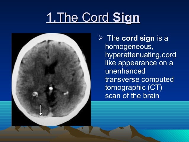 Radiology signs