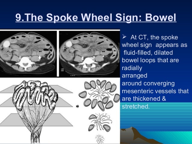 Radiology signs