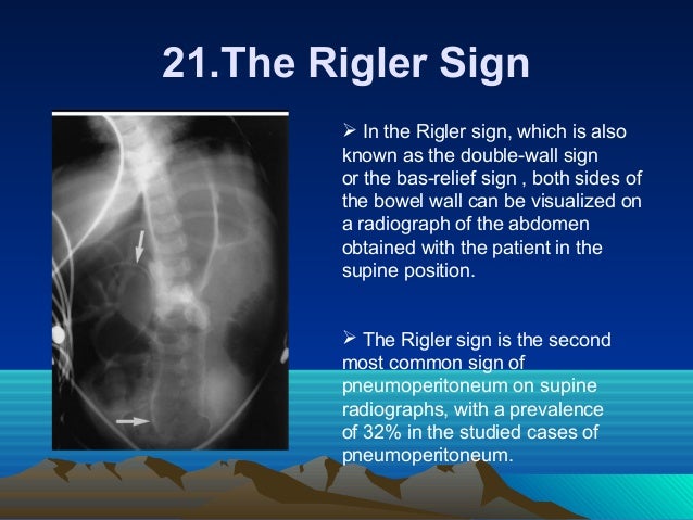 Radiology signs