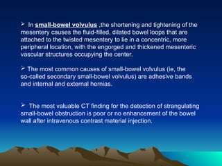 the radiological signs in imaging of gastro Aunt minnie signs.ppt
