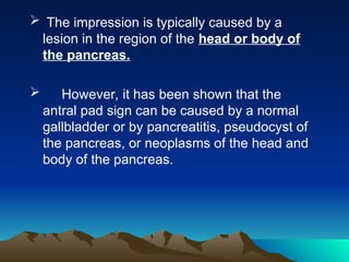 the radiological signs in imaging of gastro Aunt minnie signs.ppt