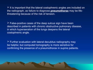 the radiological signs in imaging of gastro Aunt minnie signs.ppt