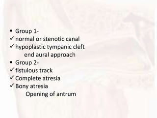 Aural atresia | PPTX