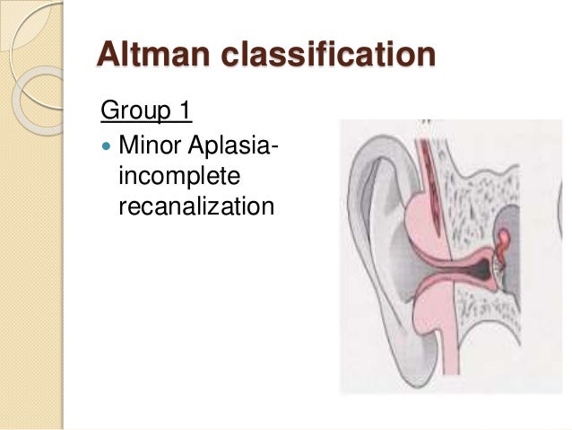 Aural atresia regional conference