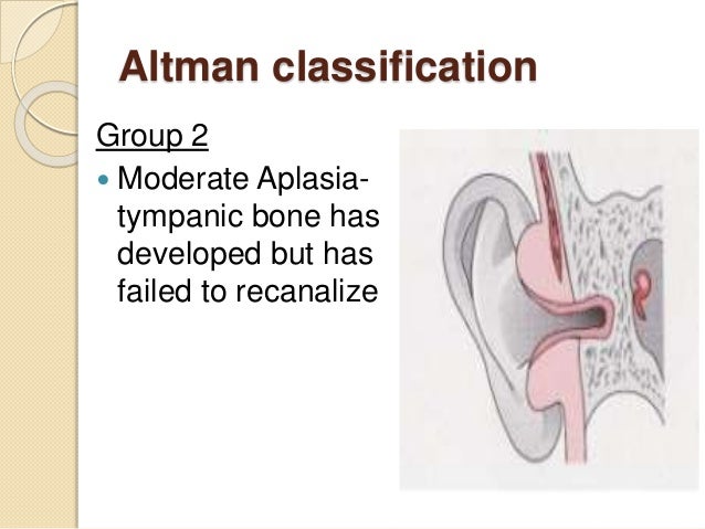 Aural atresia regional conference