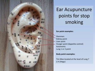 Auricular Acupuncture | PPTX