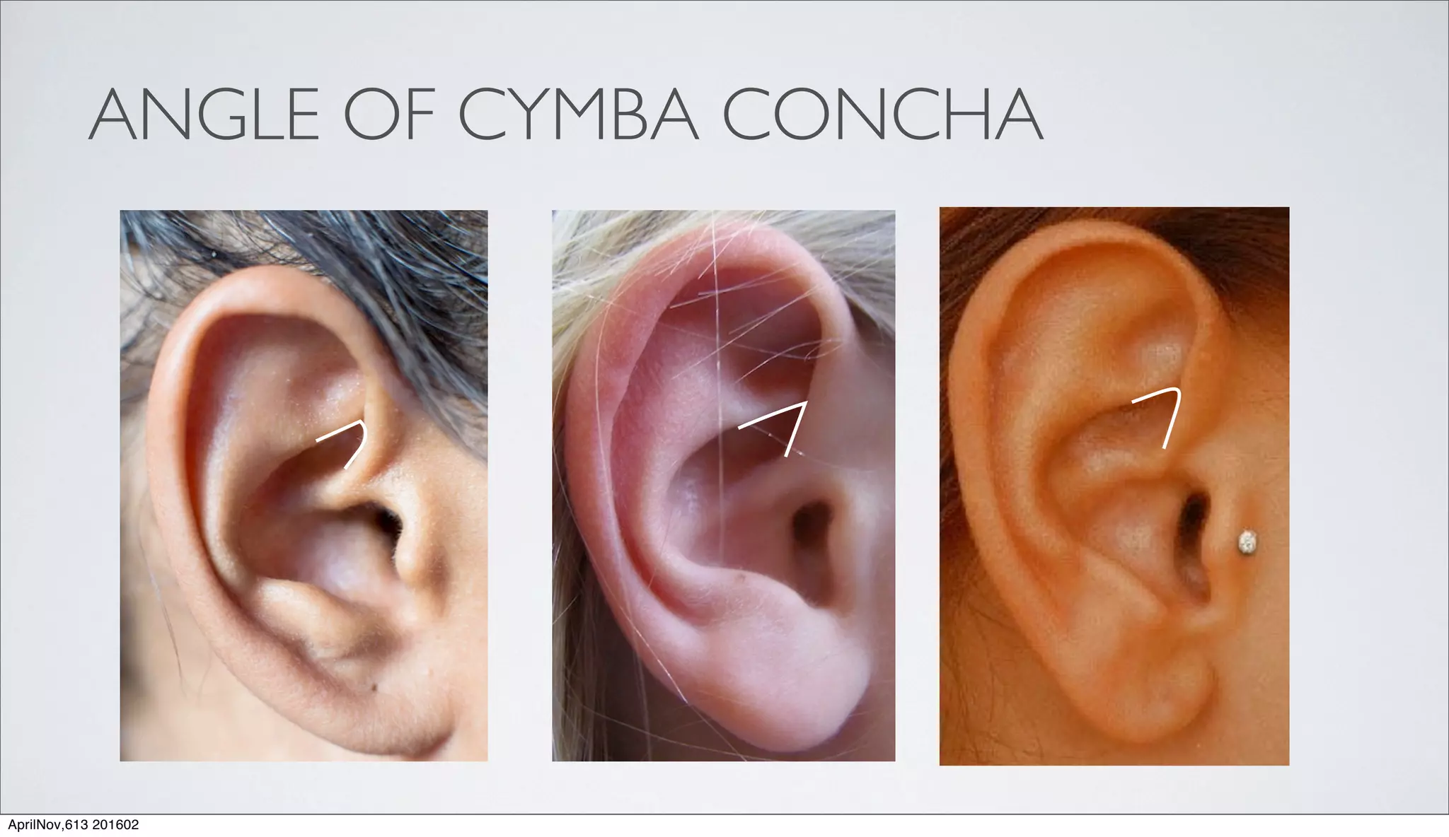 Auricular acupuncture introduction - the anatomical landmarks of the ...