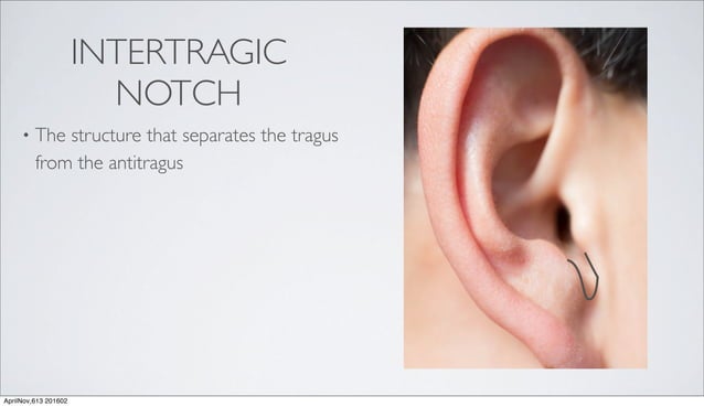 Auricular acupuncture introduction - the anatomical landmarks of the ...