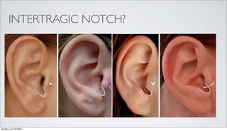 Auricular acupuncture introduction - the anatomical landmarks of the ...