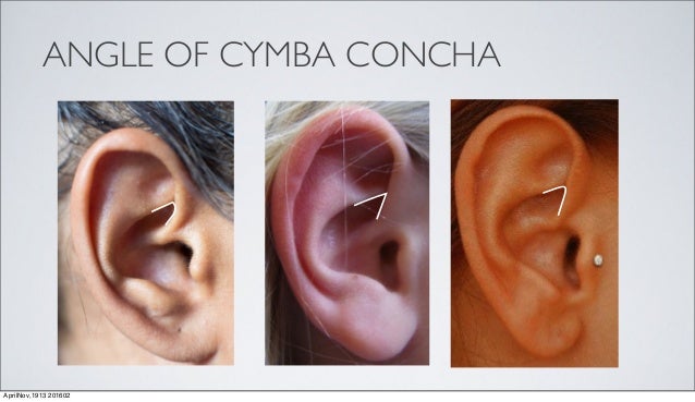 Auricular acupuncture introduction - the anatomical landmarks of the