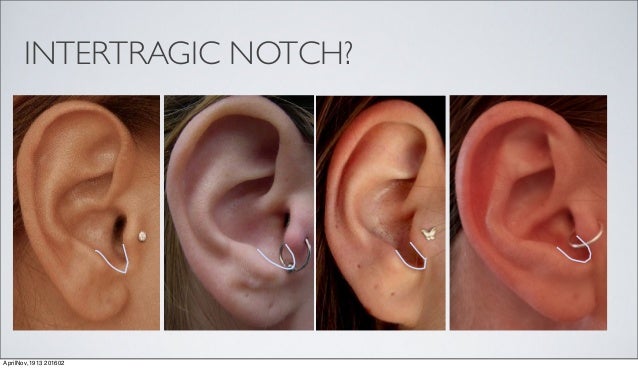 Auricular acupuncture introduction - the anatomical landmarks of the