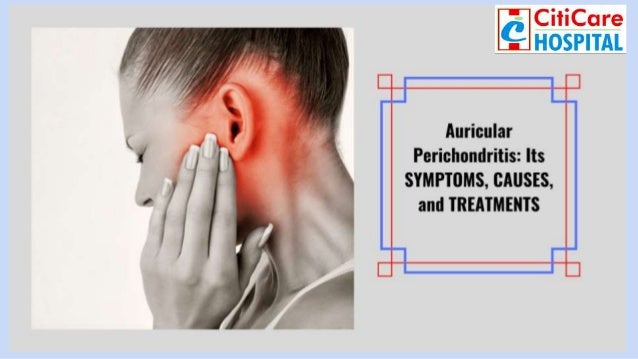 Perichondritis: symptoms, causes _ perichondritis antibiotics – FIOGN