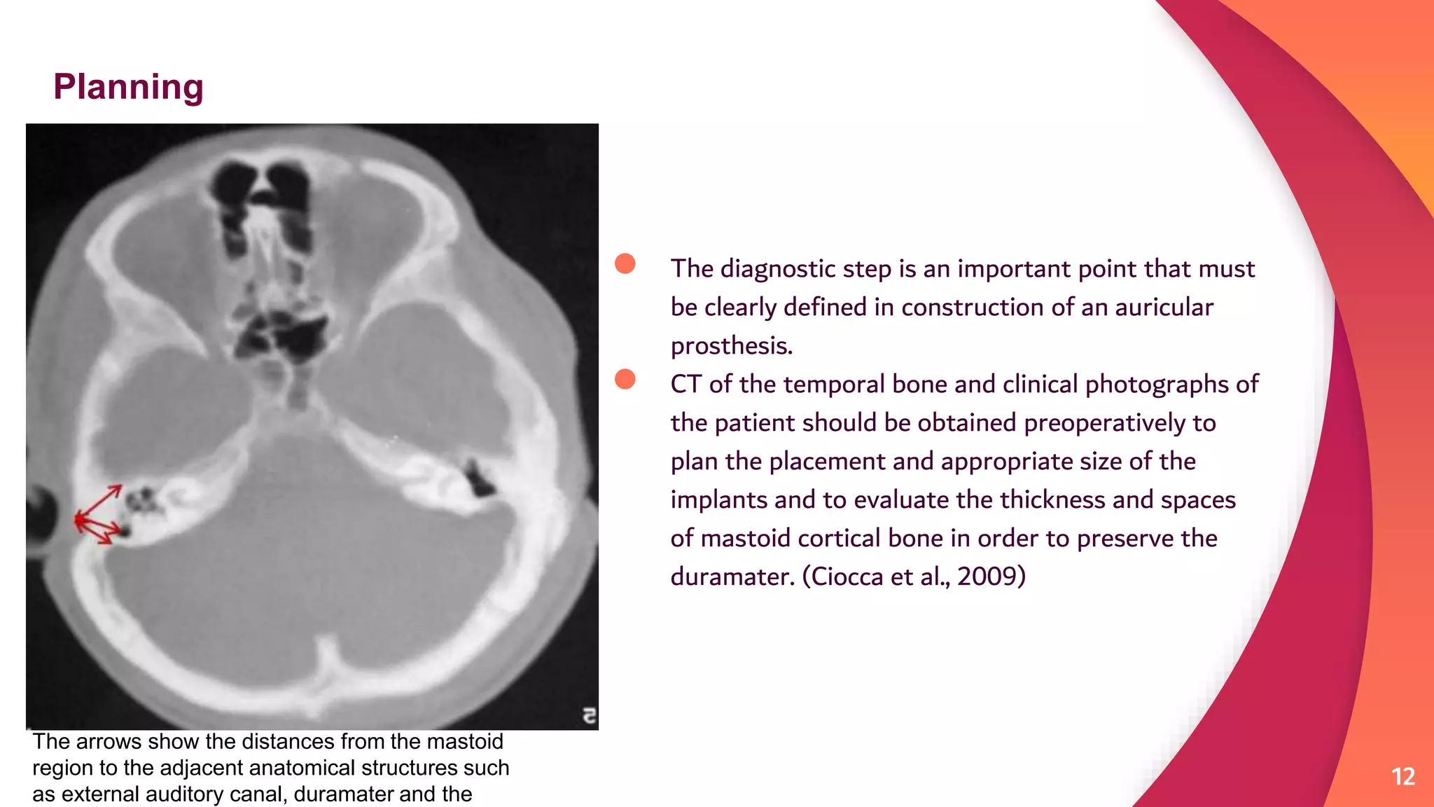 Auricular prosthesis.pptx