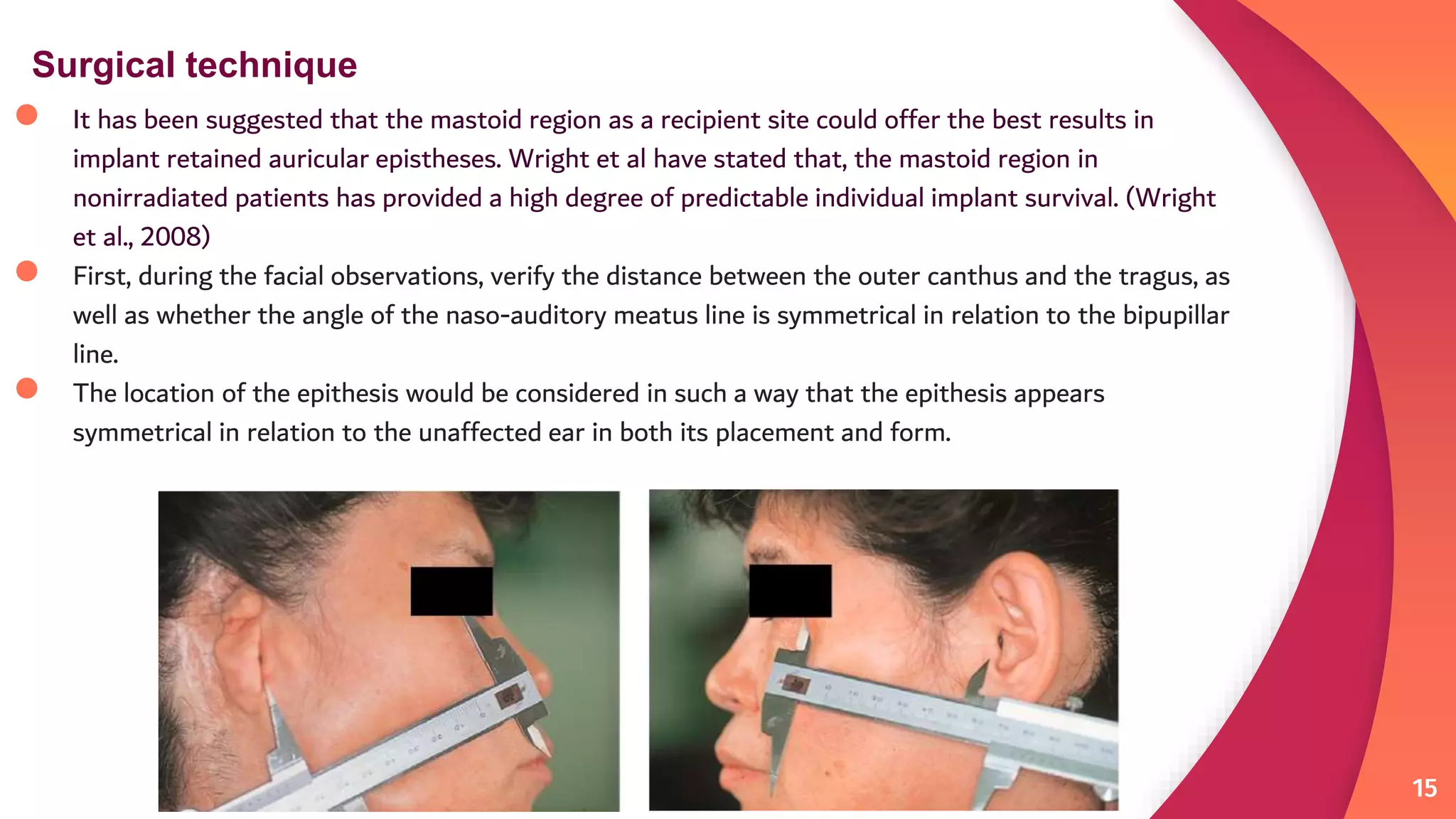 Auricular prosthesis.pptx