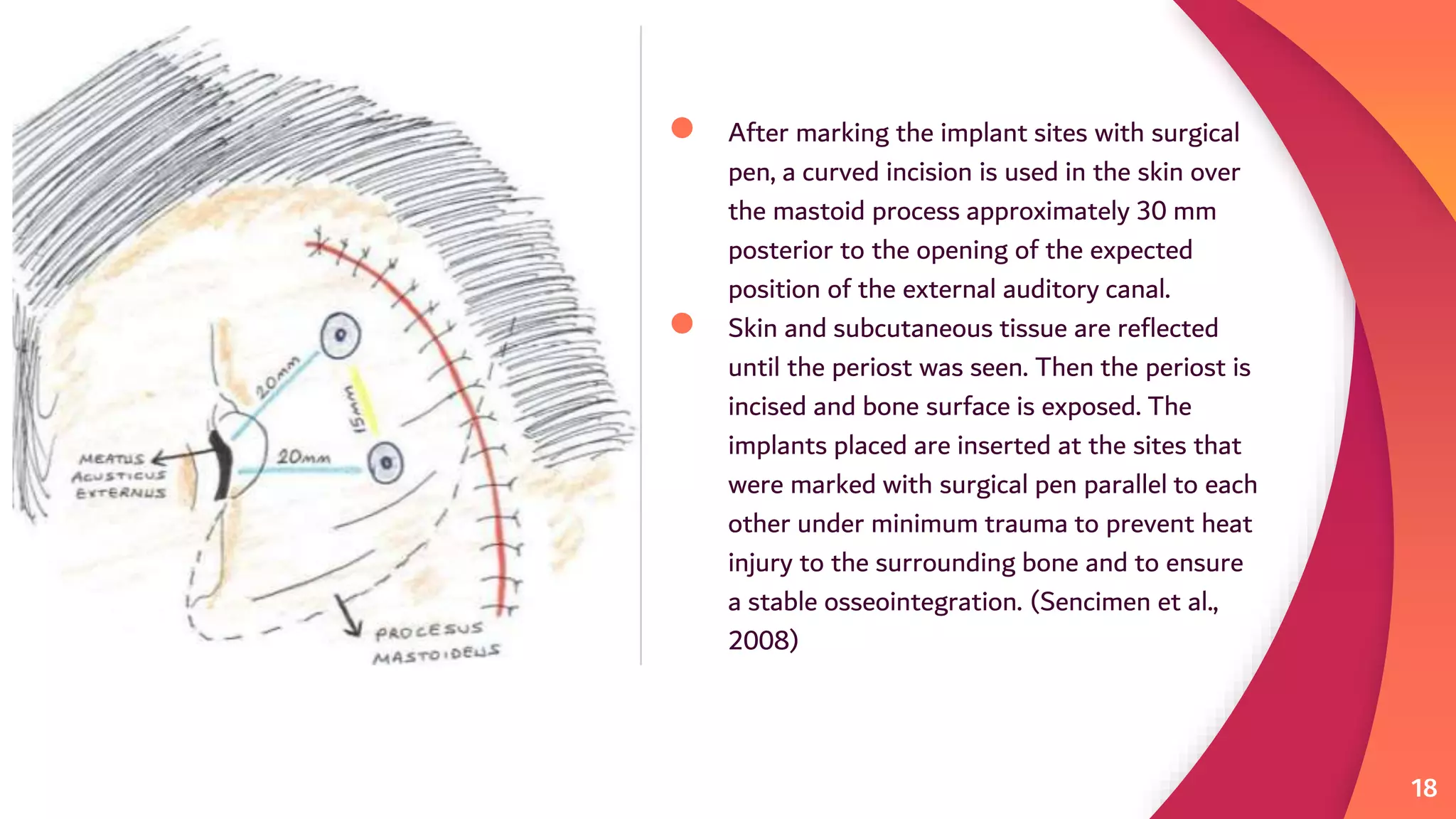 Auricular prosthesis.pptx