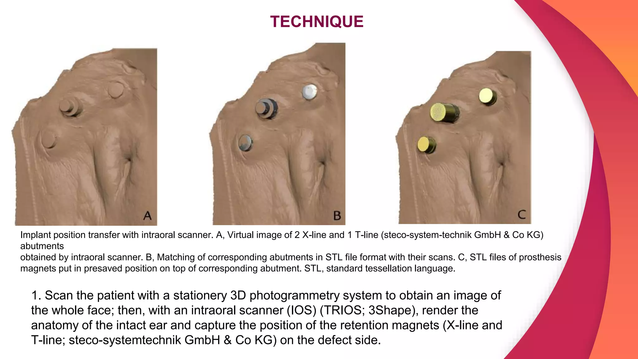 Auricular prosthesis.pptx